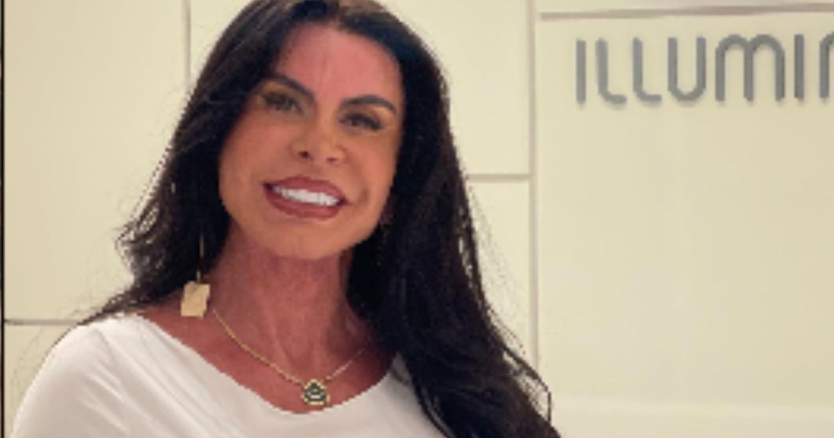 Gretchen responde haters sobre novo procedimento estético | Roma News